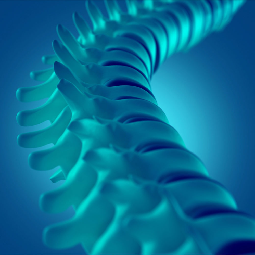What is Spinal Stenosis? - Orthopaedic Medical Group of Tampa Bay