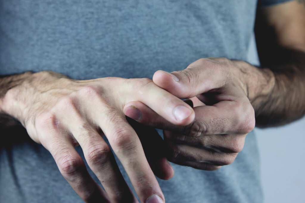 Trigger Finger Explained - Orthopaedic Medical Group of Tampa Bay