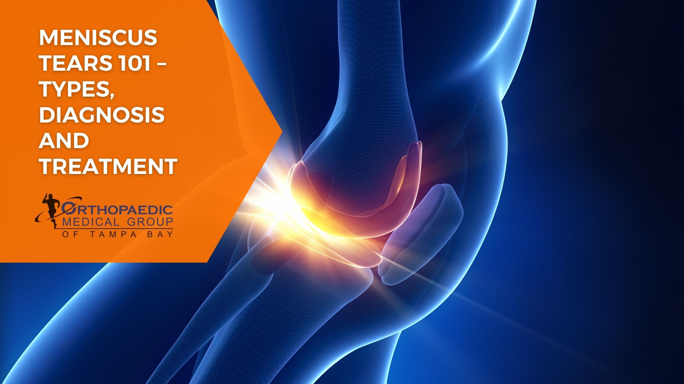 Meniscus Tears 101 - Types, Diagnosis and Treatment - OMGTB