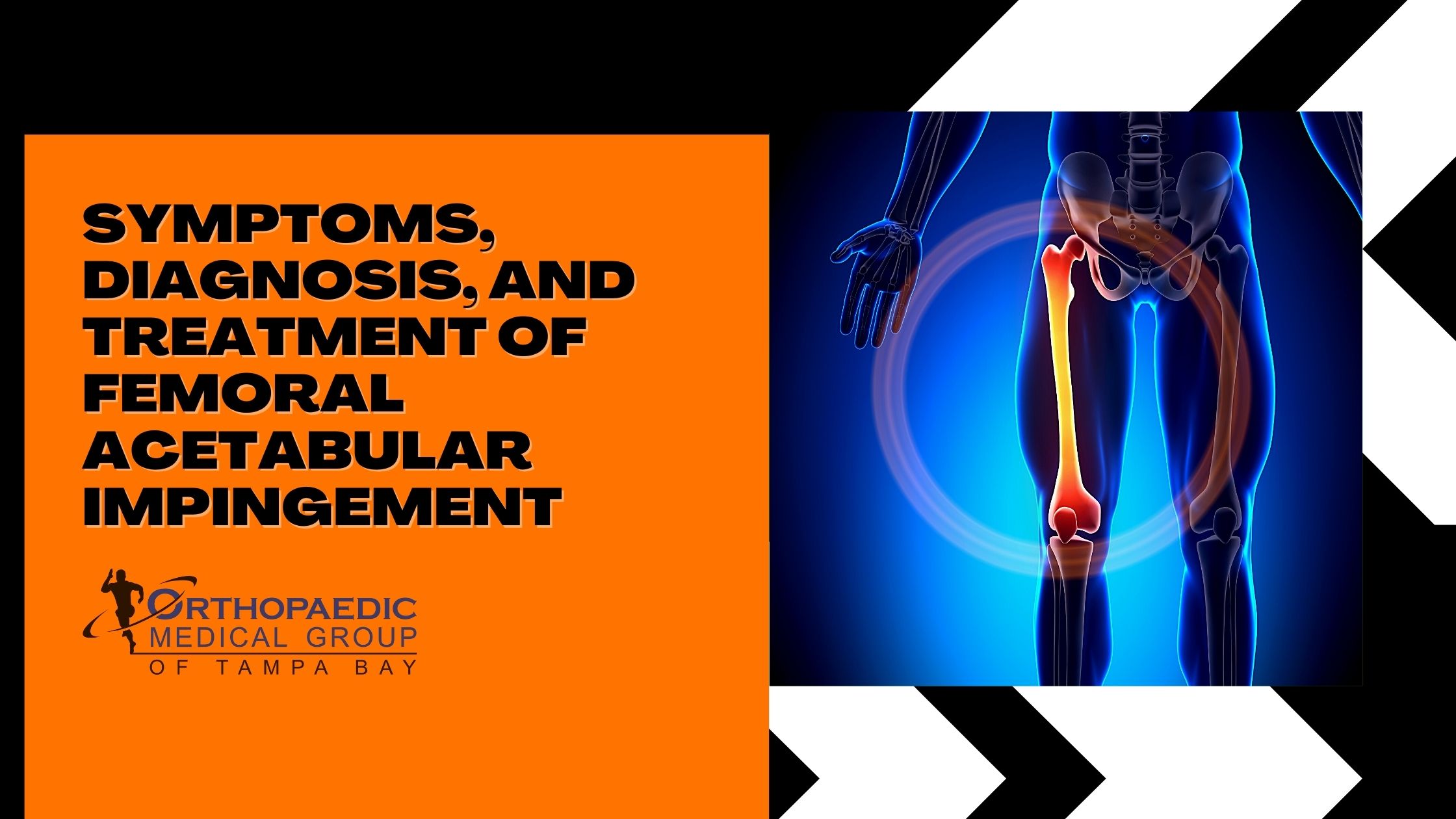 Symptoms, Diagnosis, and Treatment of Femoral Acetabular Impingement